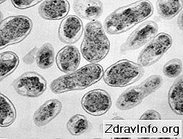 Bruceloza kod ljudi - simptomi i liječenje 👃 Portal Sinusa I Drugi. - 2025
