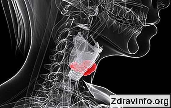 Kako liječiti sinusitis s peroksidom vodika? 👃 Portal Sinusa I Drugi ...