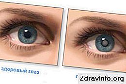 Kapi za oči Vitafakol - za izbjegavanje ili usporavanje razvoja ...