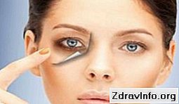 Jak a co mohu rychle zredukovat modřinu pod očima? 👃 Portál Sinus A ...