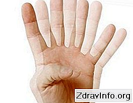 Jaké jsou nebezpečí spojivkových očních cyst? Efektivní léčba patologie ...