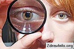 Co je endokrinní oftalmopatie, její příznaky a léčebné metody 👃 Portál ...